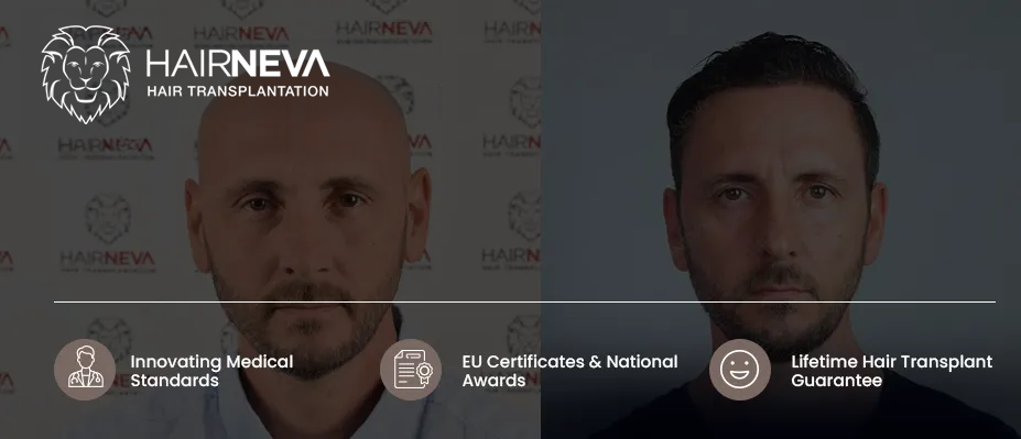 Hair Transplant Turkey, Istanbul Price (Cost) 2026 - Hairneva